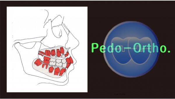LA 포스치과 | Pedo-Ortho. Course > Pedo-Ortho. Course